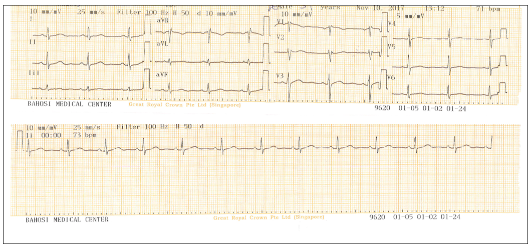 Cervical spondylosis mimicking cardiac angina - Journal of Case Reports ...